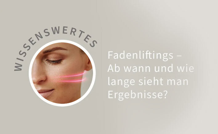 Wissenwertes über Fadenliftings | seralea®